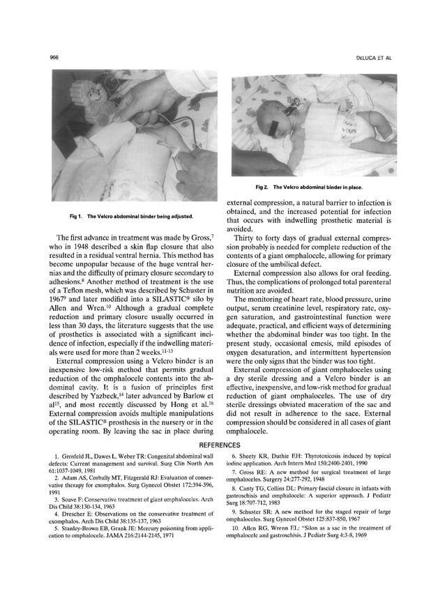 external compression as initial management of giant omphaloceles.pdf ...