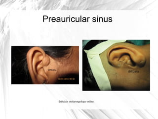 Diseases of external ear | ODP