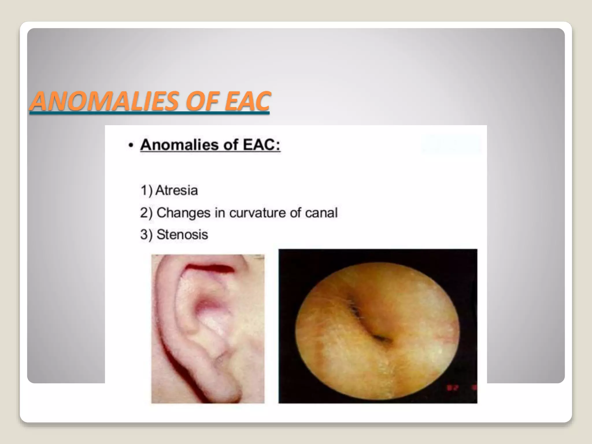ANATOMY OF EXTERNAL EAR | PPTX