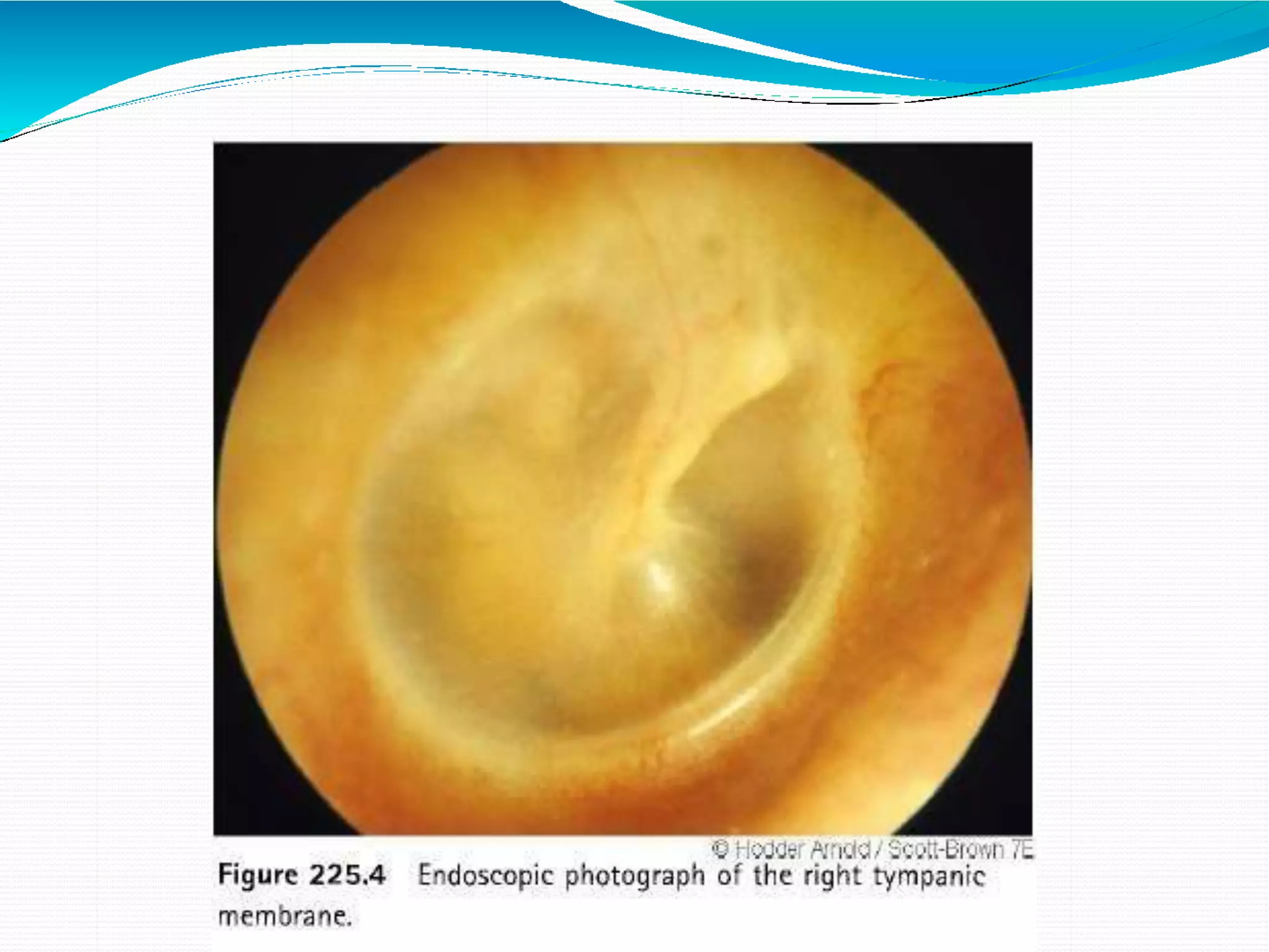 ANATOMY OF EXTERNAL EAR | PPTX