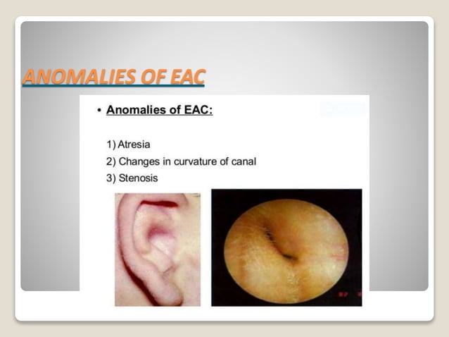ANATOMY OF EXTERNAL EAR | PPTX