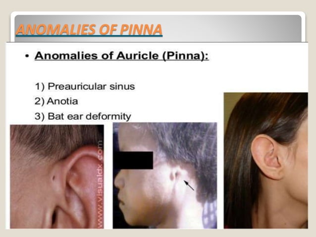 ANATOMY OF EXTERNAL EAR | PPTX