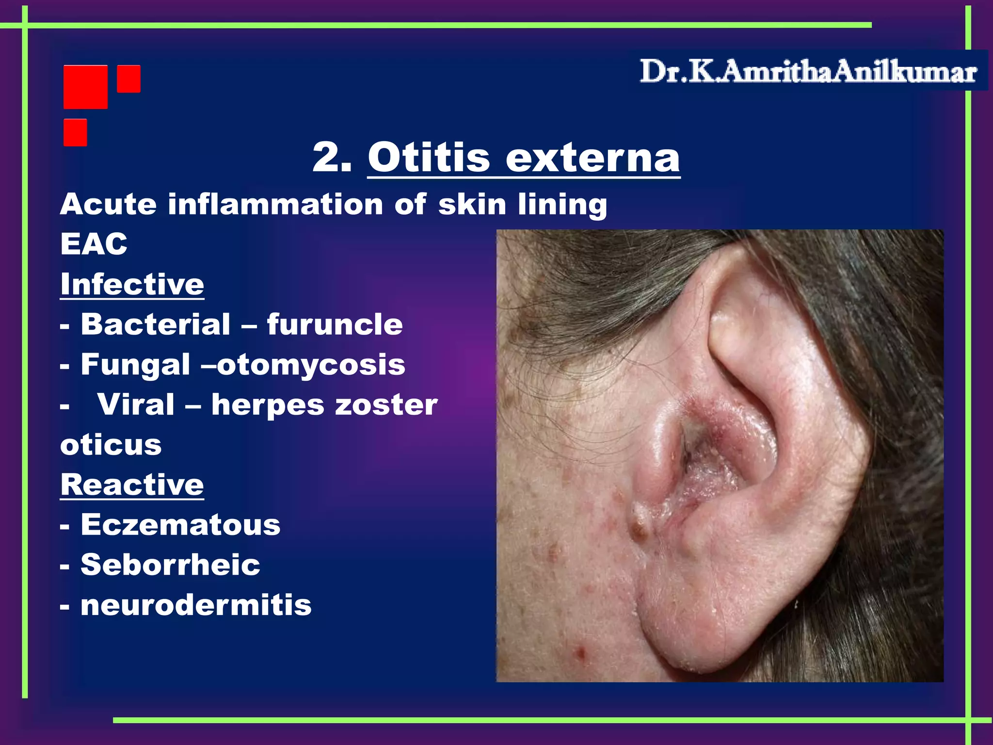 Anatomy of ear(Part 1-External Ear) by Dr.K.AmrithaAnilkumar | PPTX ...