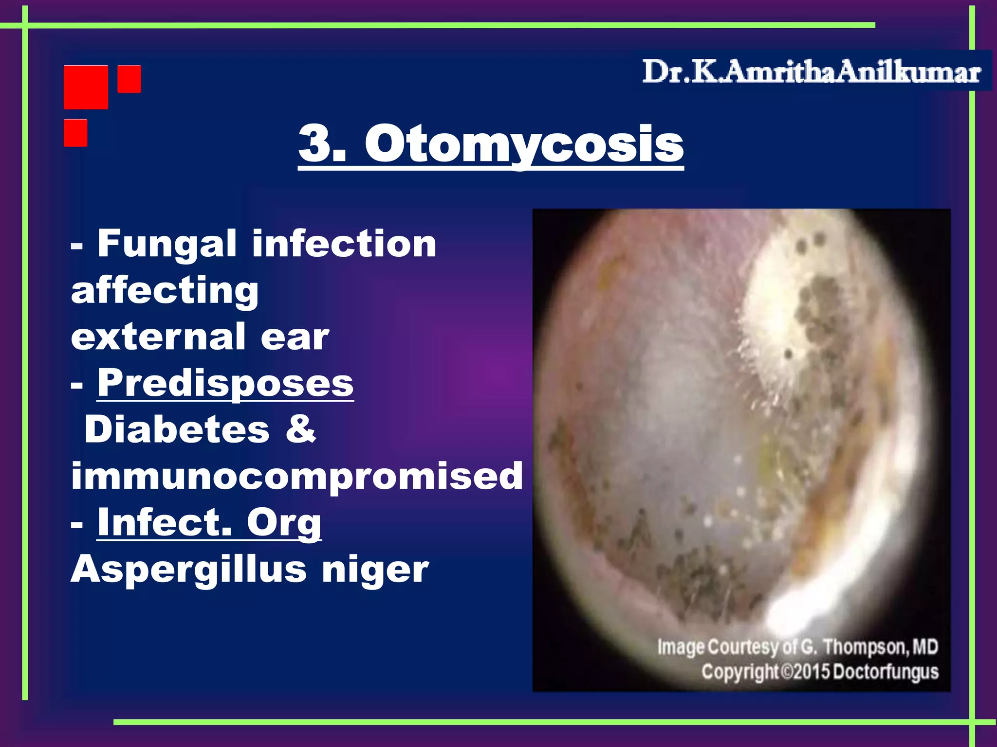 Anatomy of ear(Part 1-External Ear) by Dr.K.AmrithaAnilkumar | PPTX ...