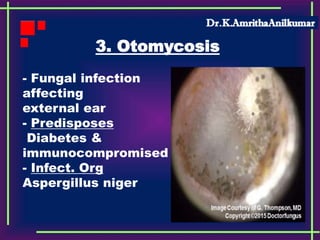 Anatomy of ear(Part 1-External Ear) by Dr.K.AmrithaAnilkumar | PPTX
