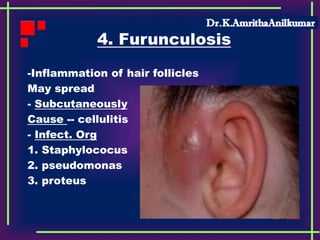 Anatomy of ear(Part 1-External Ear) by Dr.K.AmrithaAnilkumar | PPTX ...