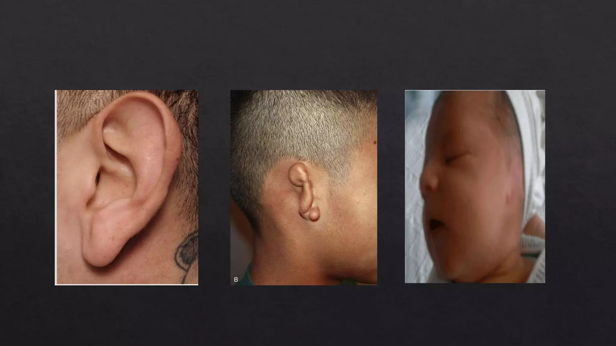 External ear anatomy | PPTX