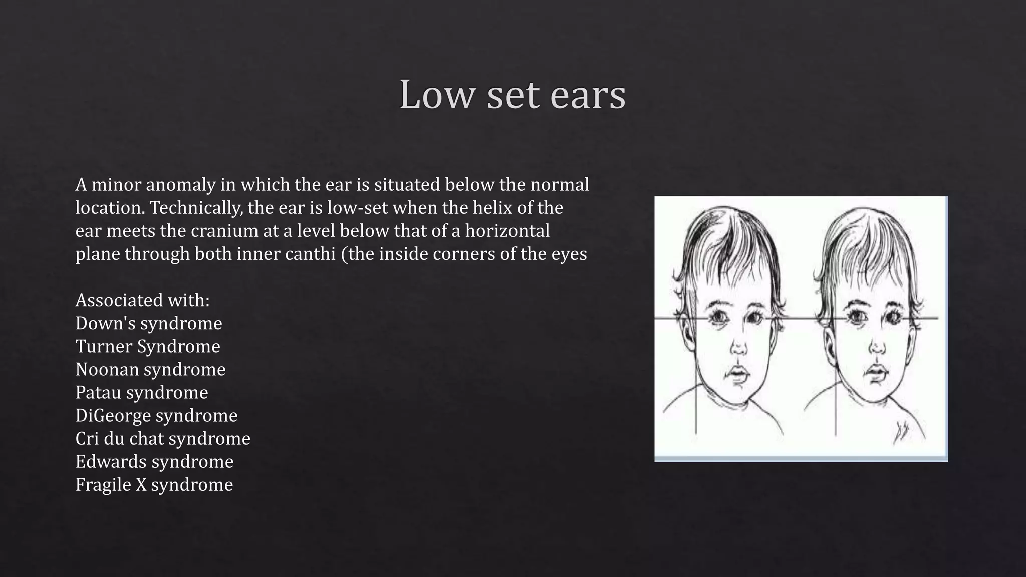 External ear anatomy | PPTX