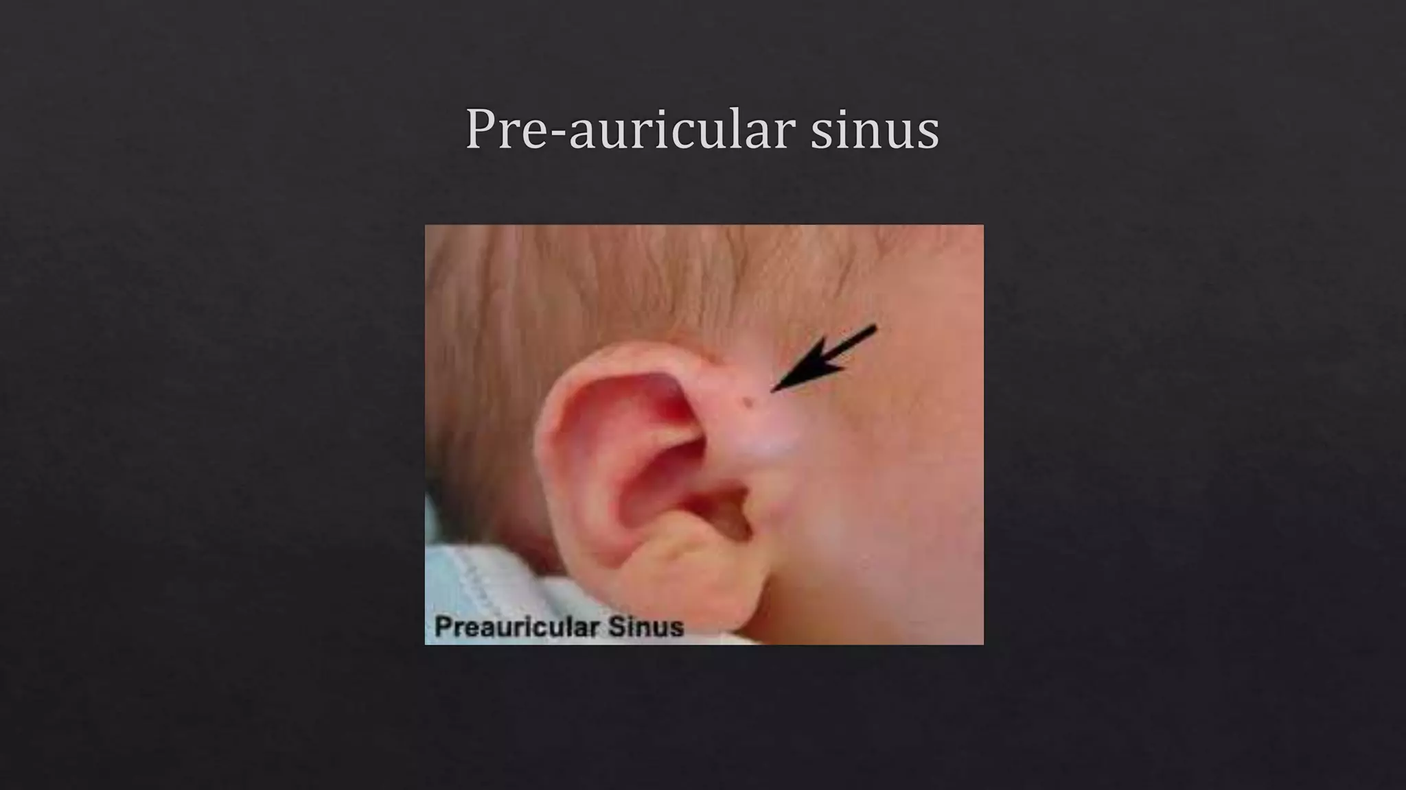 External ear anatomy | PPTX