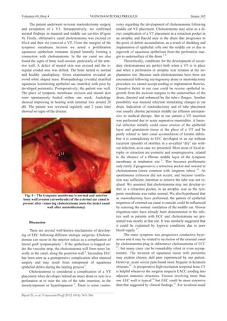 External ear canal cholesteatoma after ventilation tube insertion | PDF