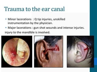 External ear disease-1.pdfuyhhhhhhhhhhhh | PDF