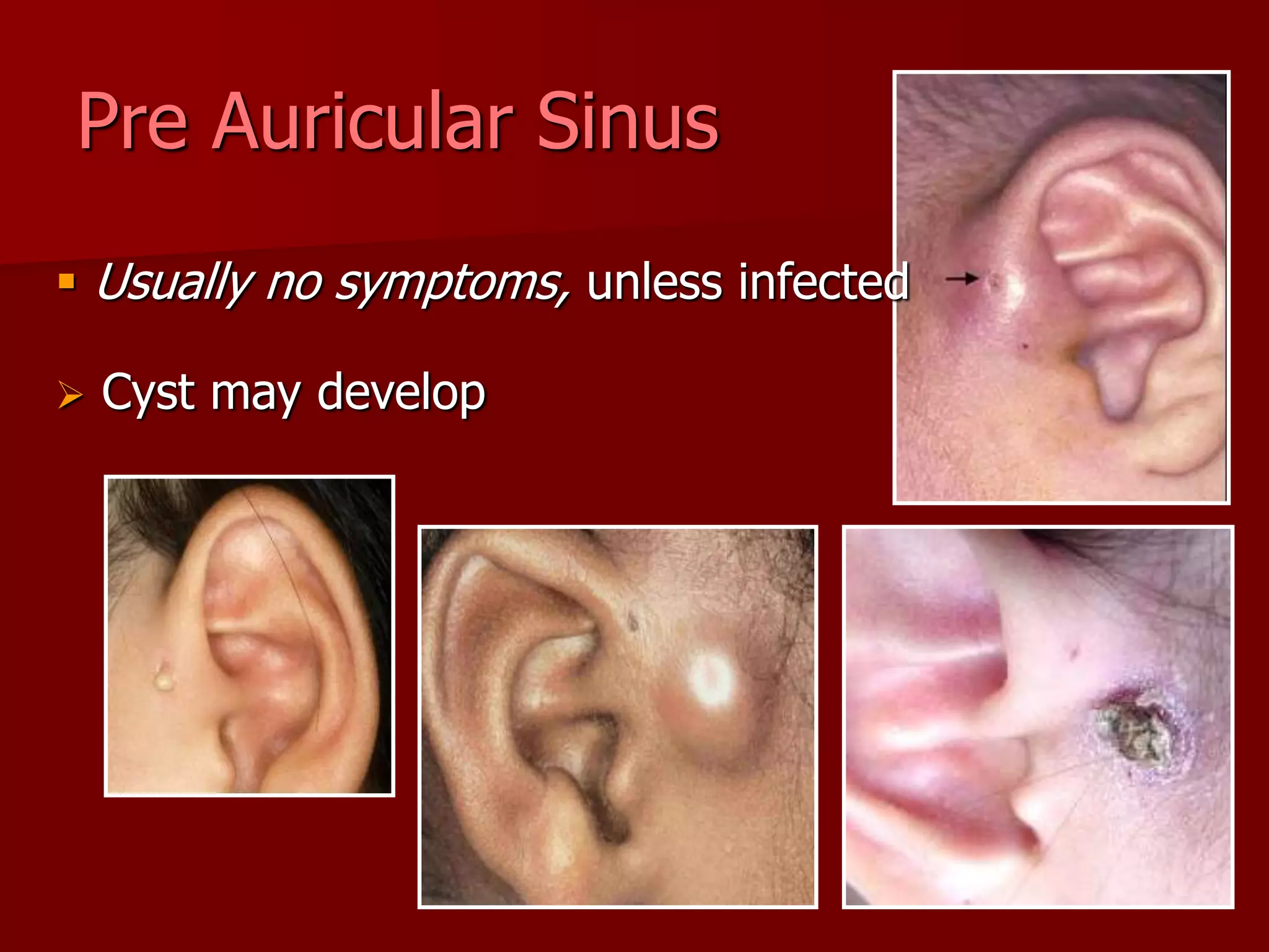 Diseases of the External Ear | PPT