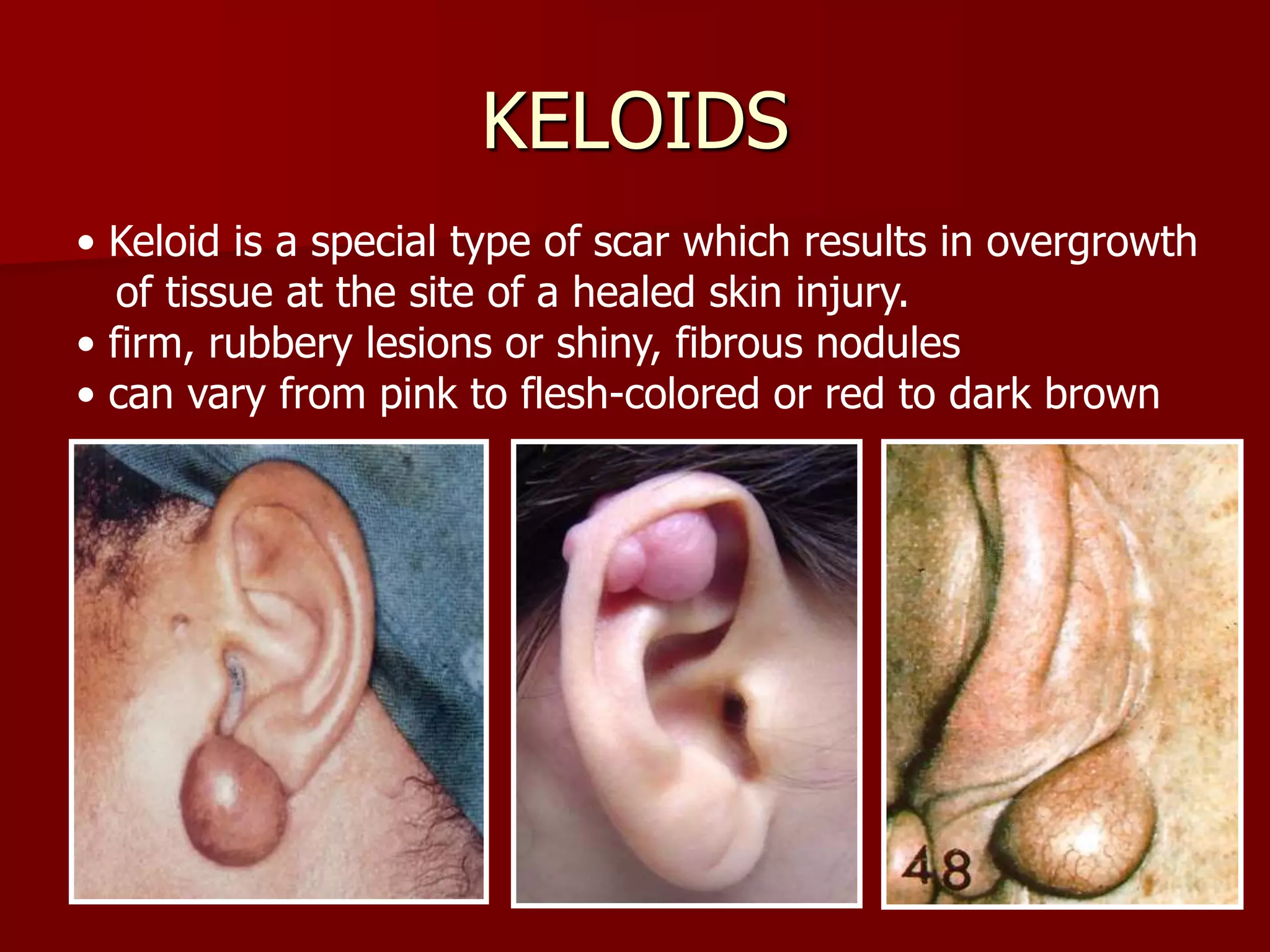 Diseases of the External Ear | PPT