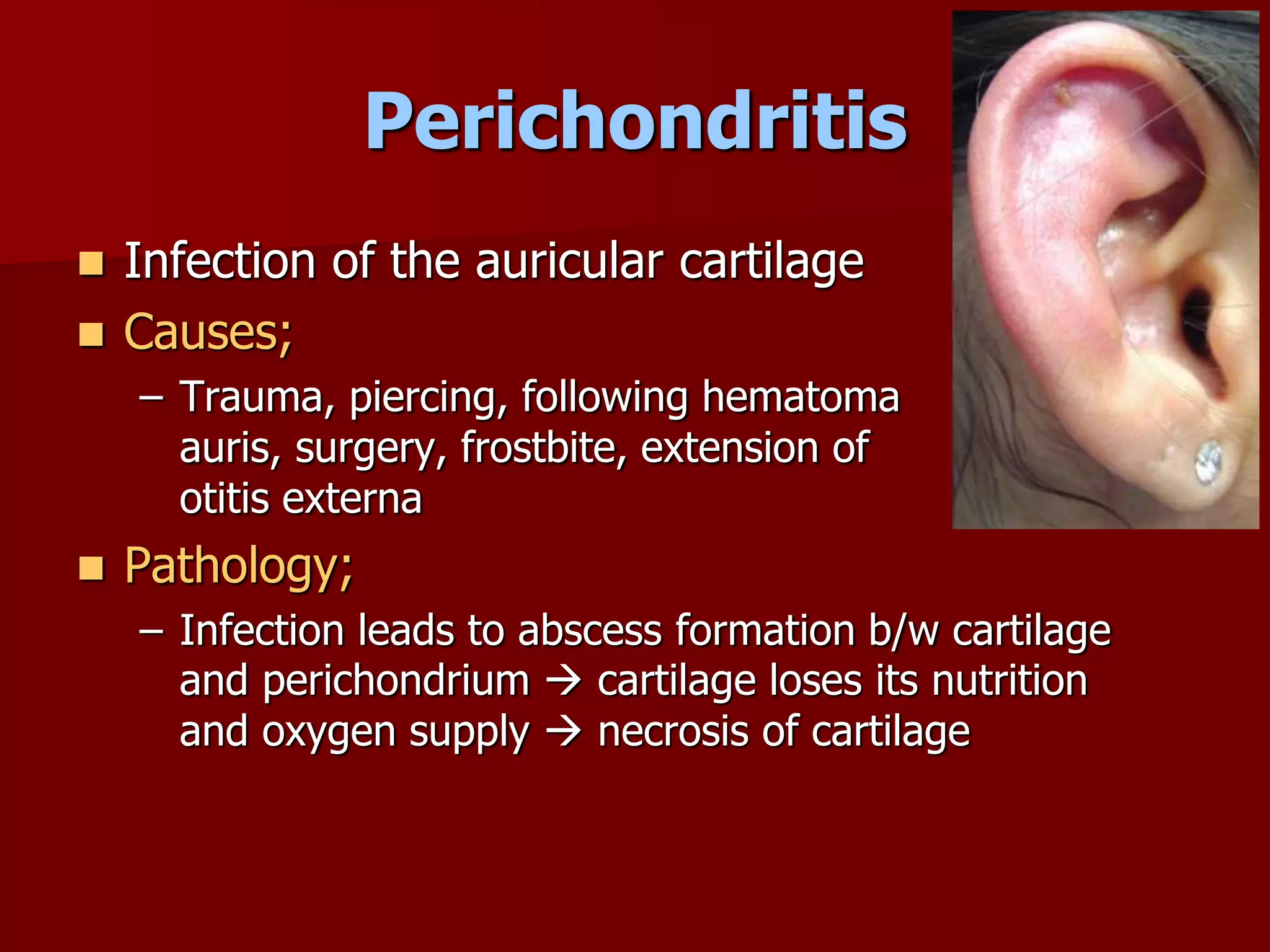 Diseases of the External Ear | PPT