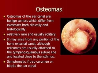 Diseases of the External Ear | PPT