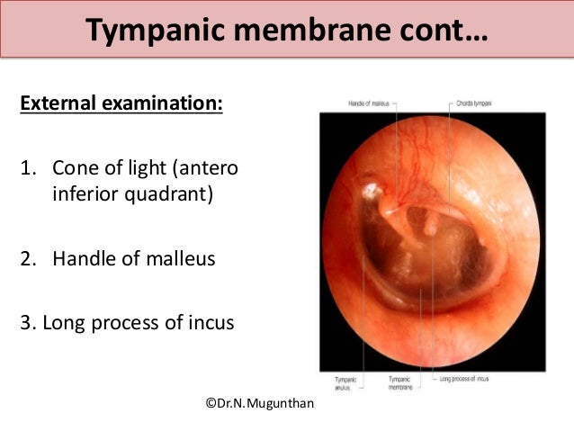 Normal Tympanic Membrane Anatomy The Normal Tympanic Membrane | Ento Key