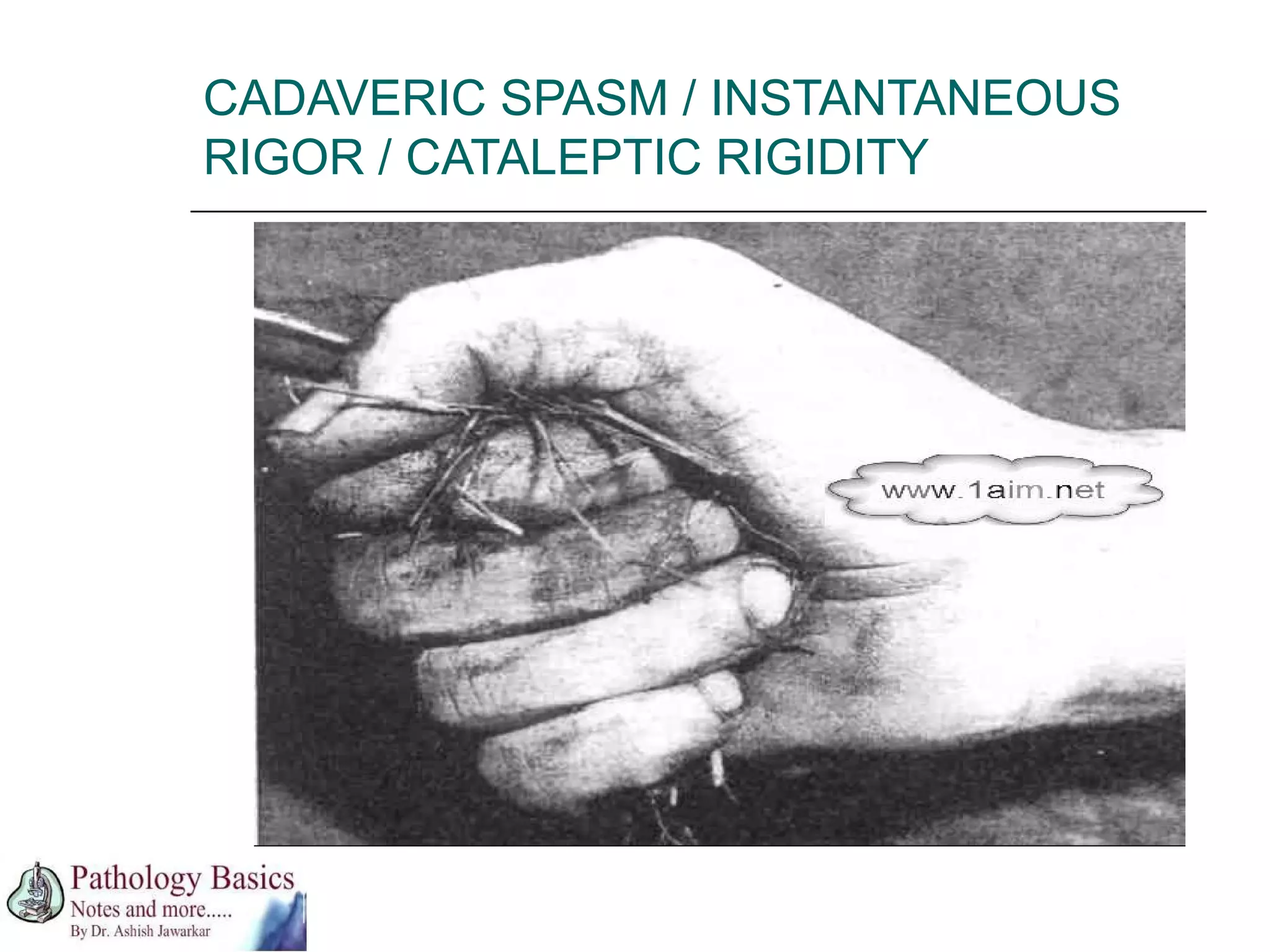 External examination at autopsy | PPT