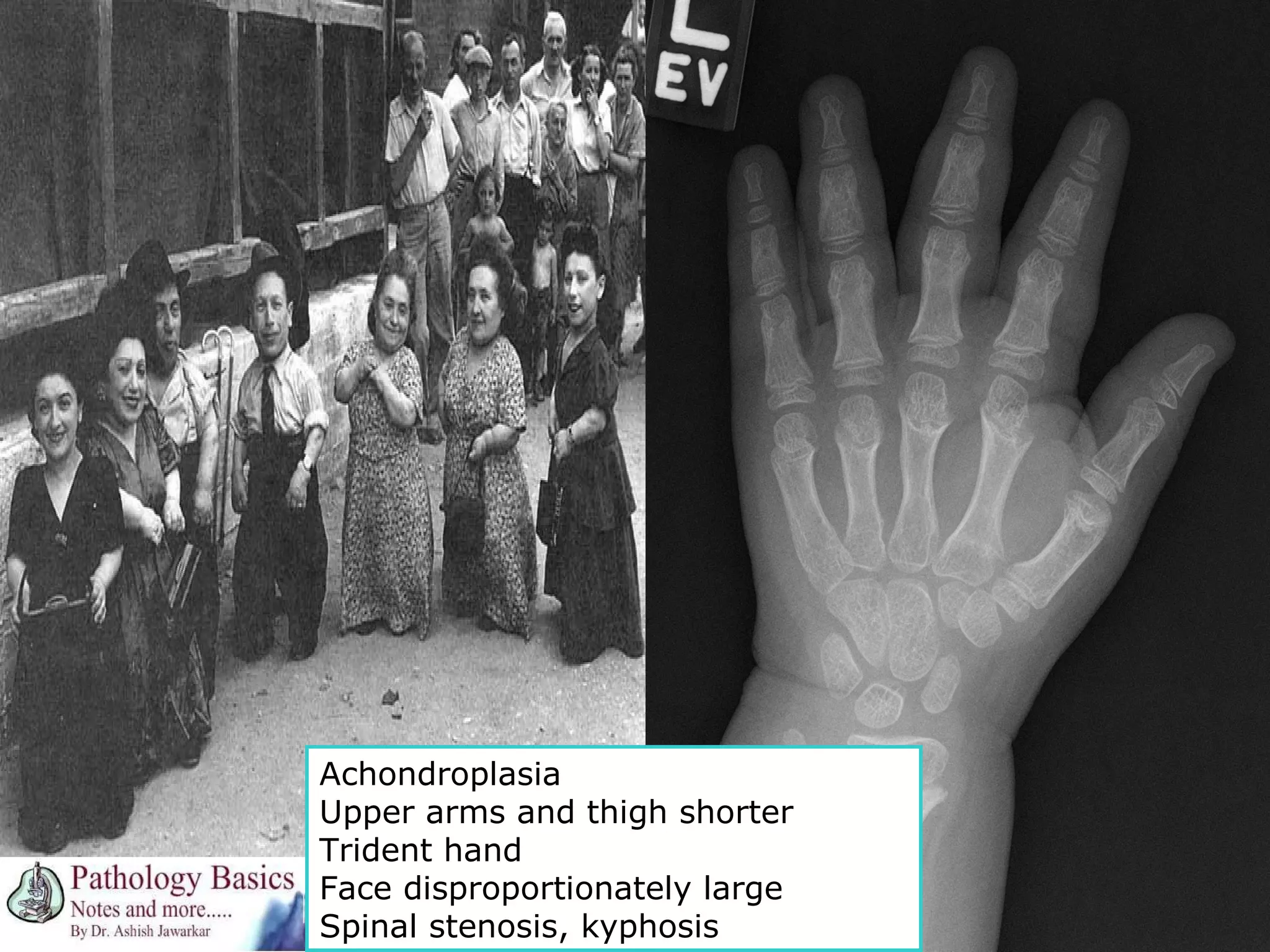 External examination at autopsy | PPT