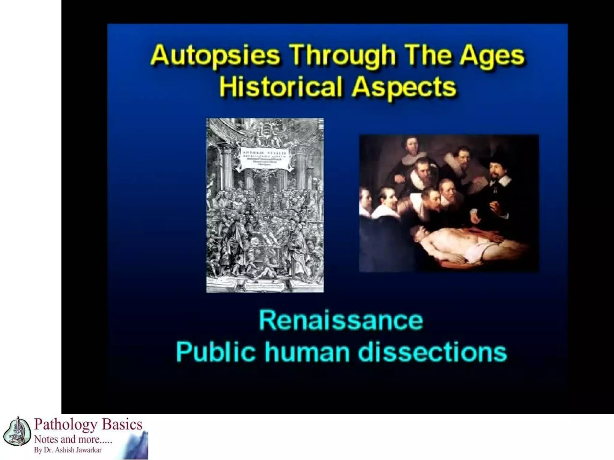 External examination at autopsy | PPT