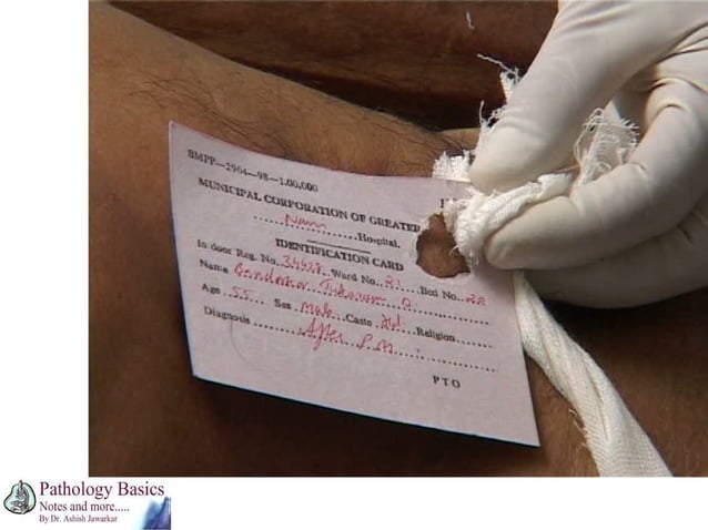 External examination at autopsy | PPT | Diseases and Conditions ...