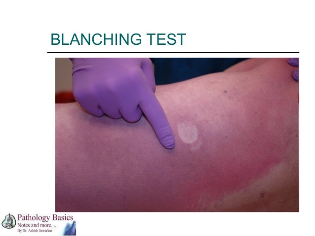 External examination at autopsy