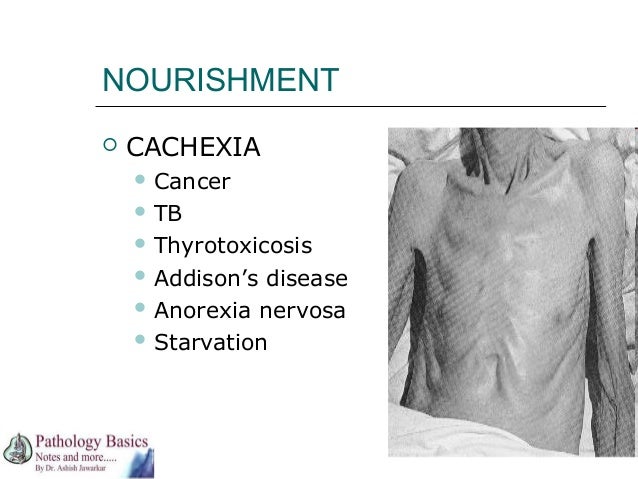 External examination at autopsy