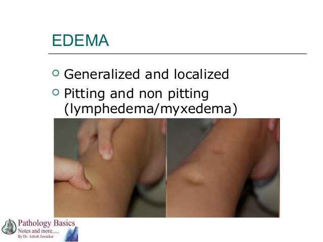 External examination at autopsy