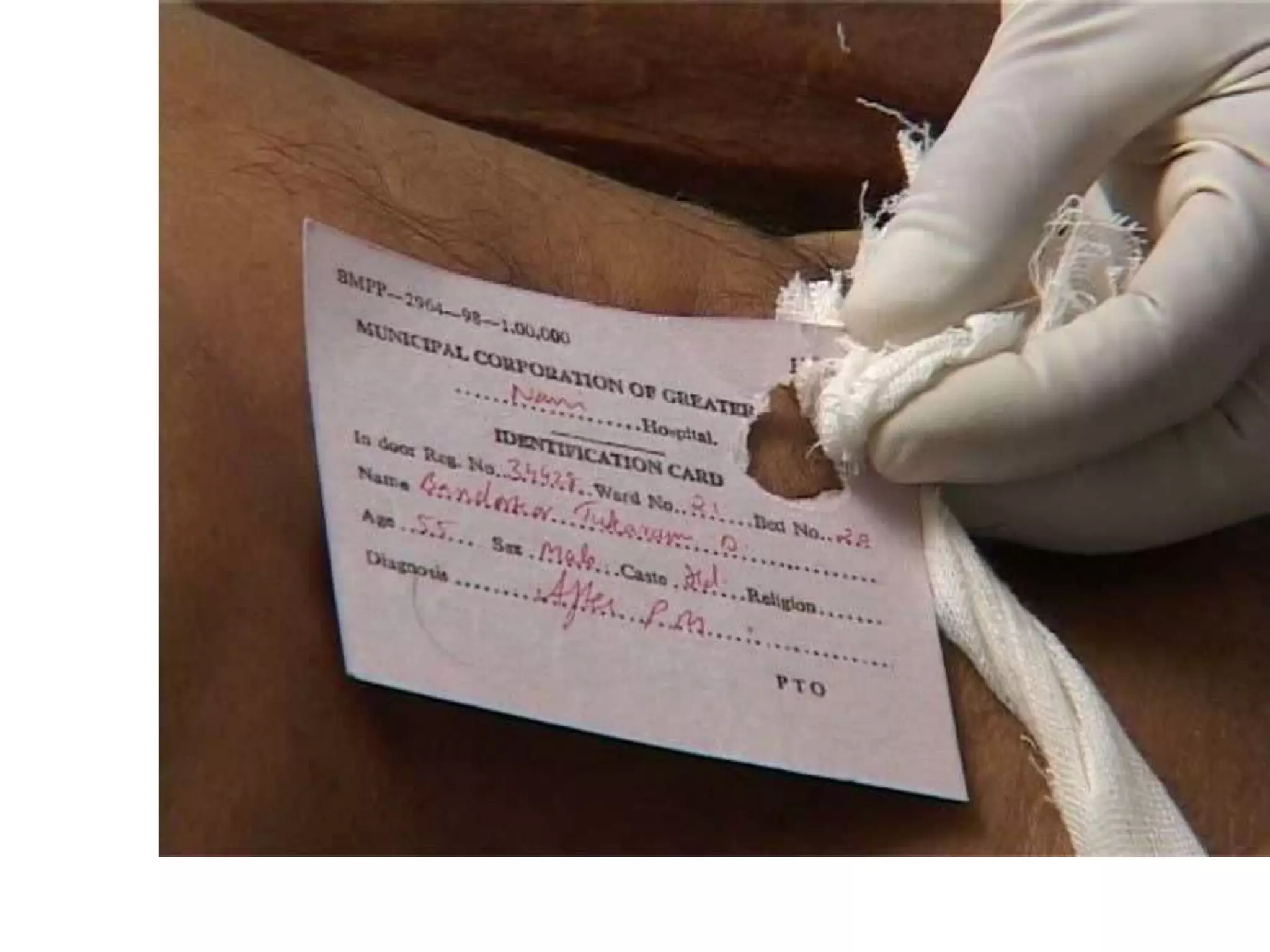 External examination in autopsies with pro forma | PPTX