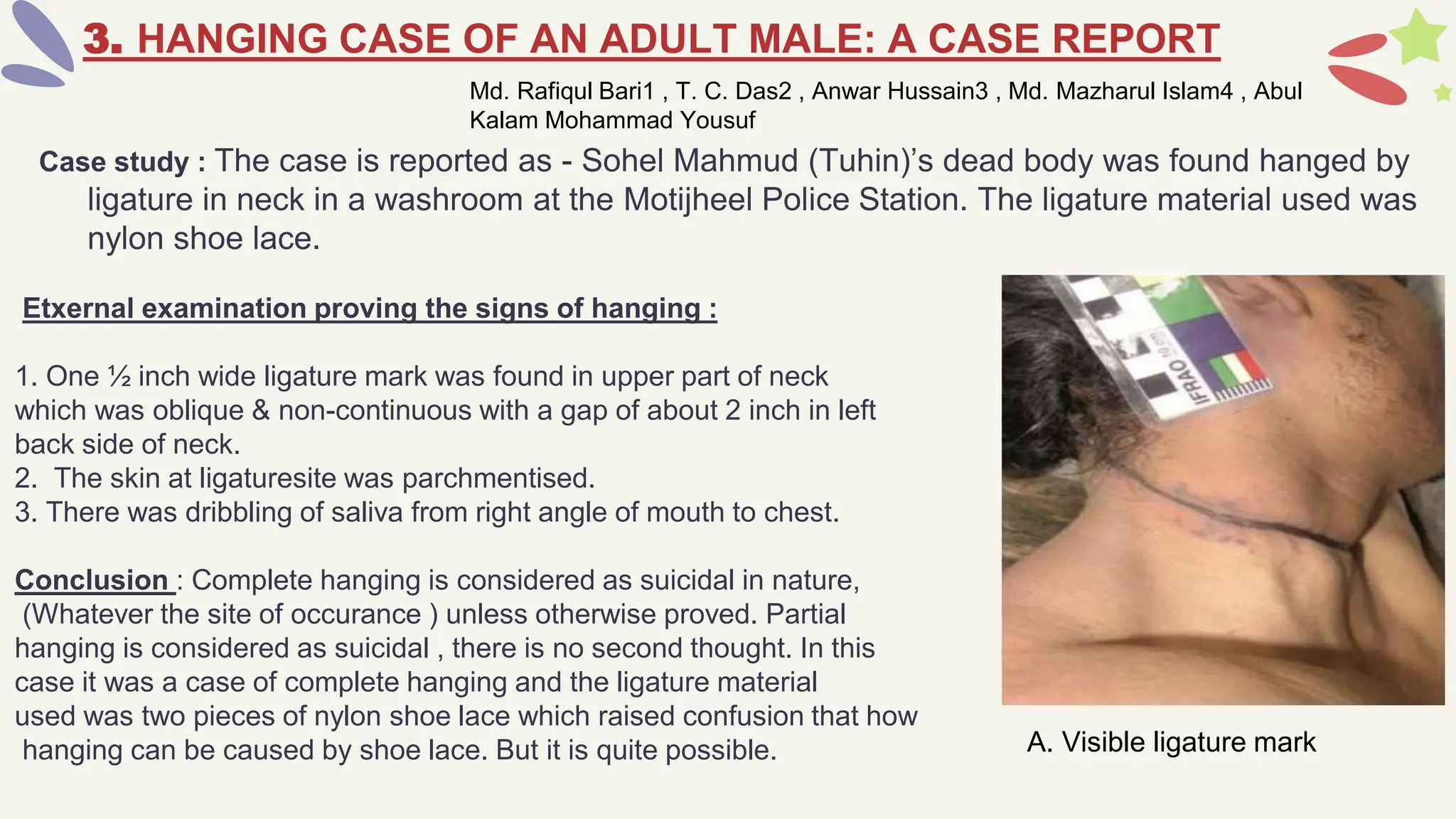 External examination in hanging cases.pptx