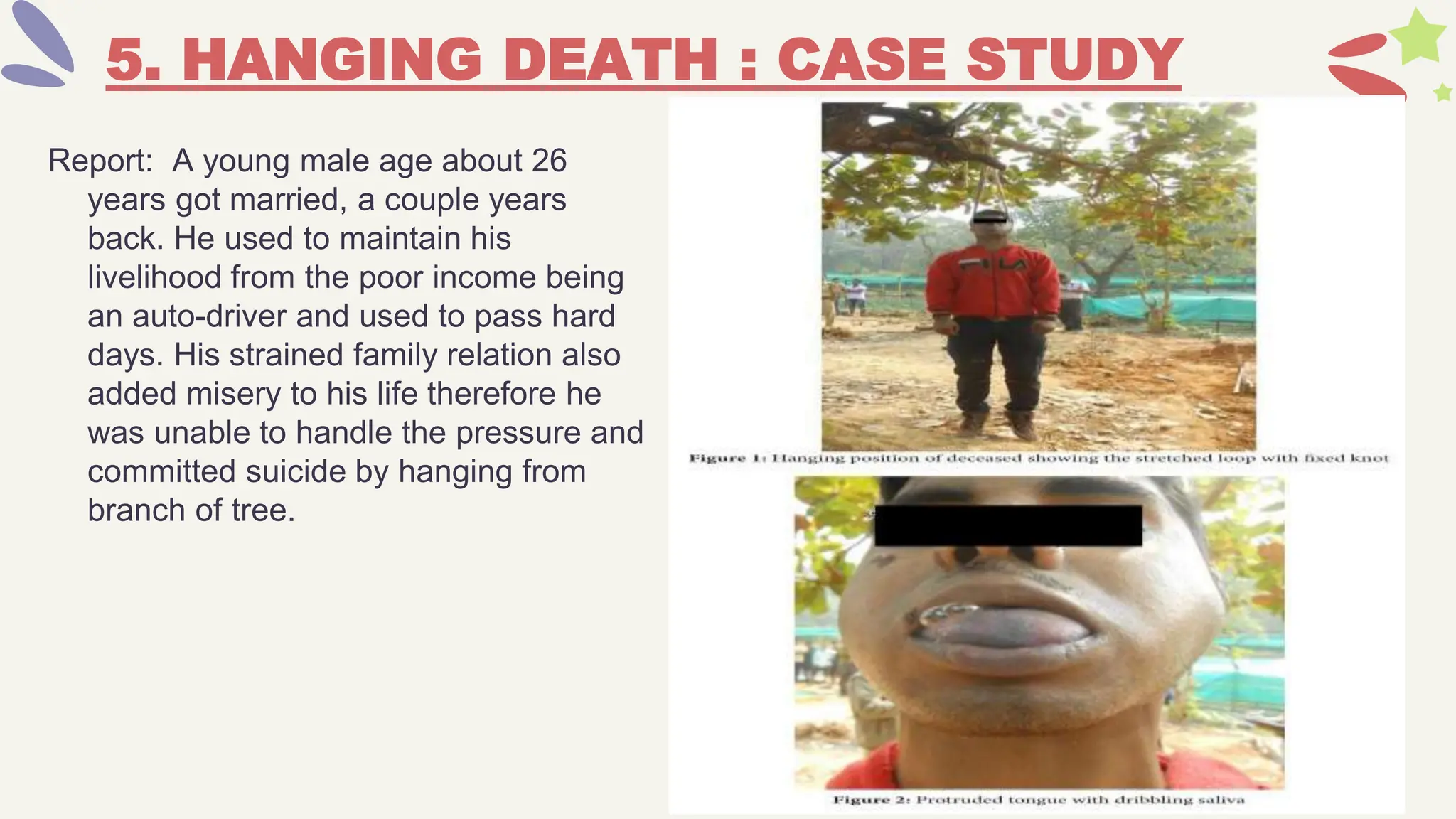 External examination in hanging cases.pptx