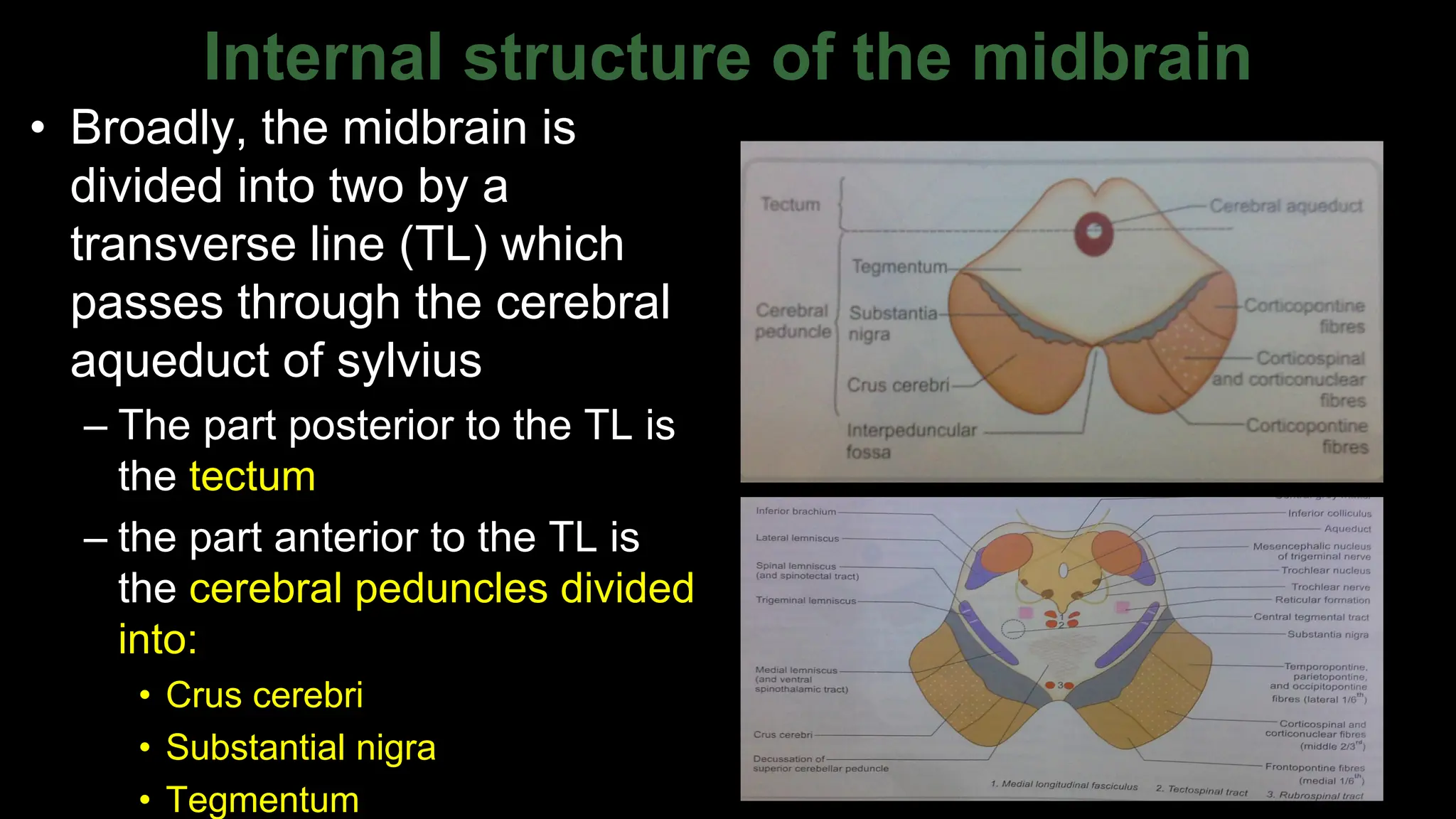 External features of brain stem (Anatomy).pdf