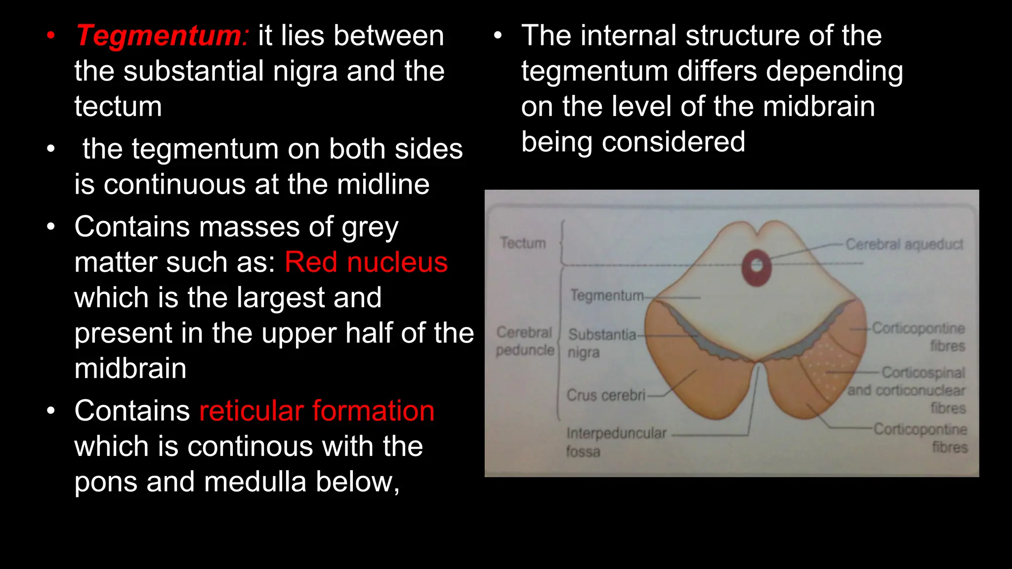 External features of brain stem (Anatomy).pdf