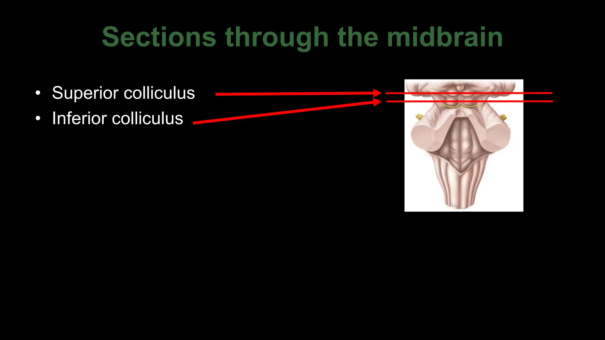 External features of brain stem (Anatomy).pdf