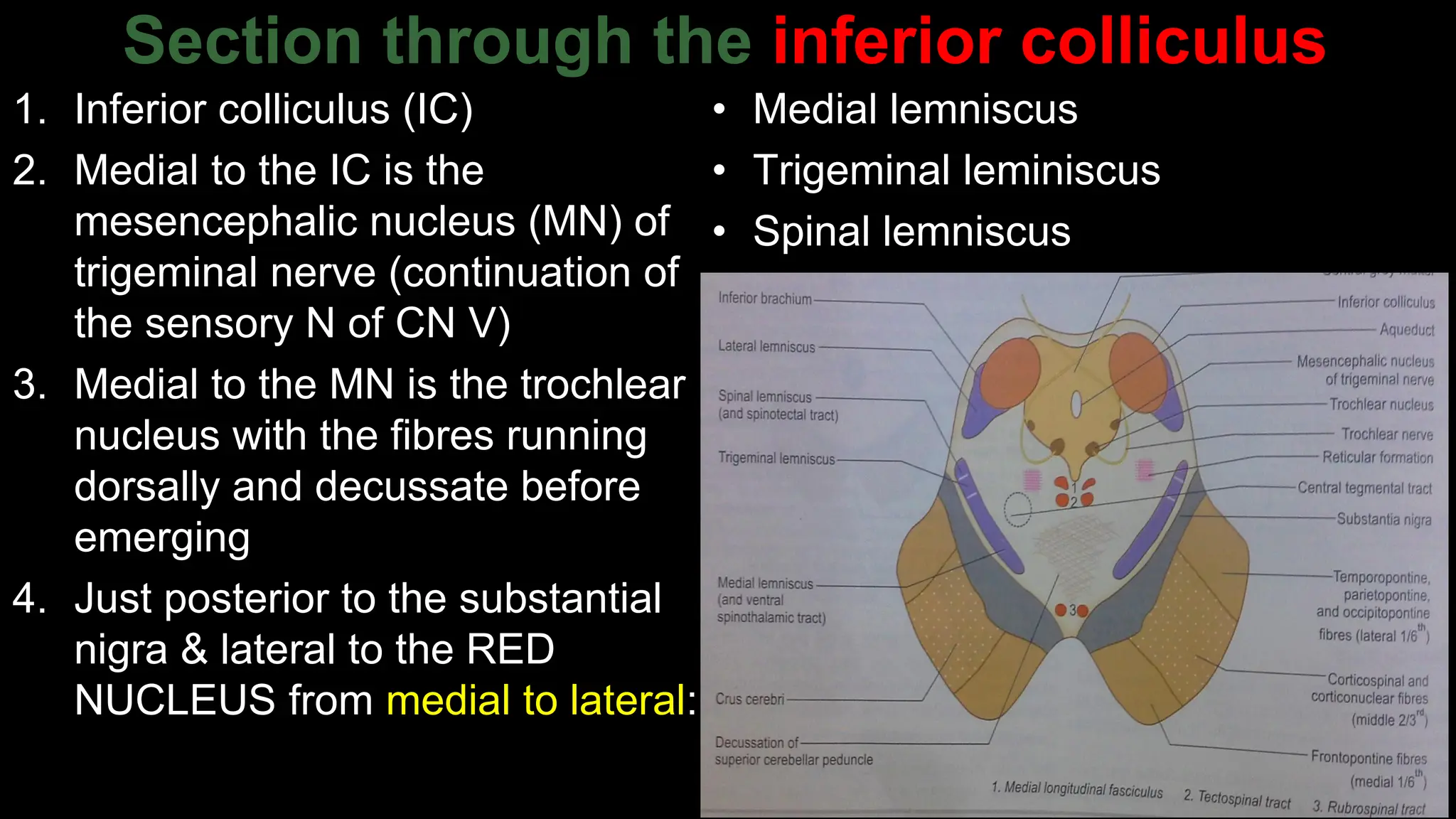 External features of brain stem (Anatomy).pdf