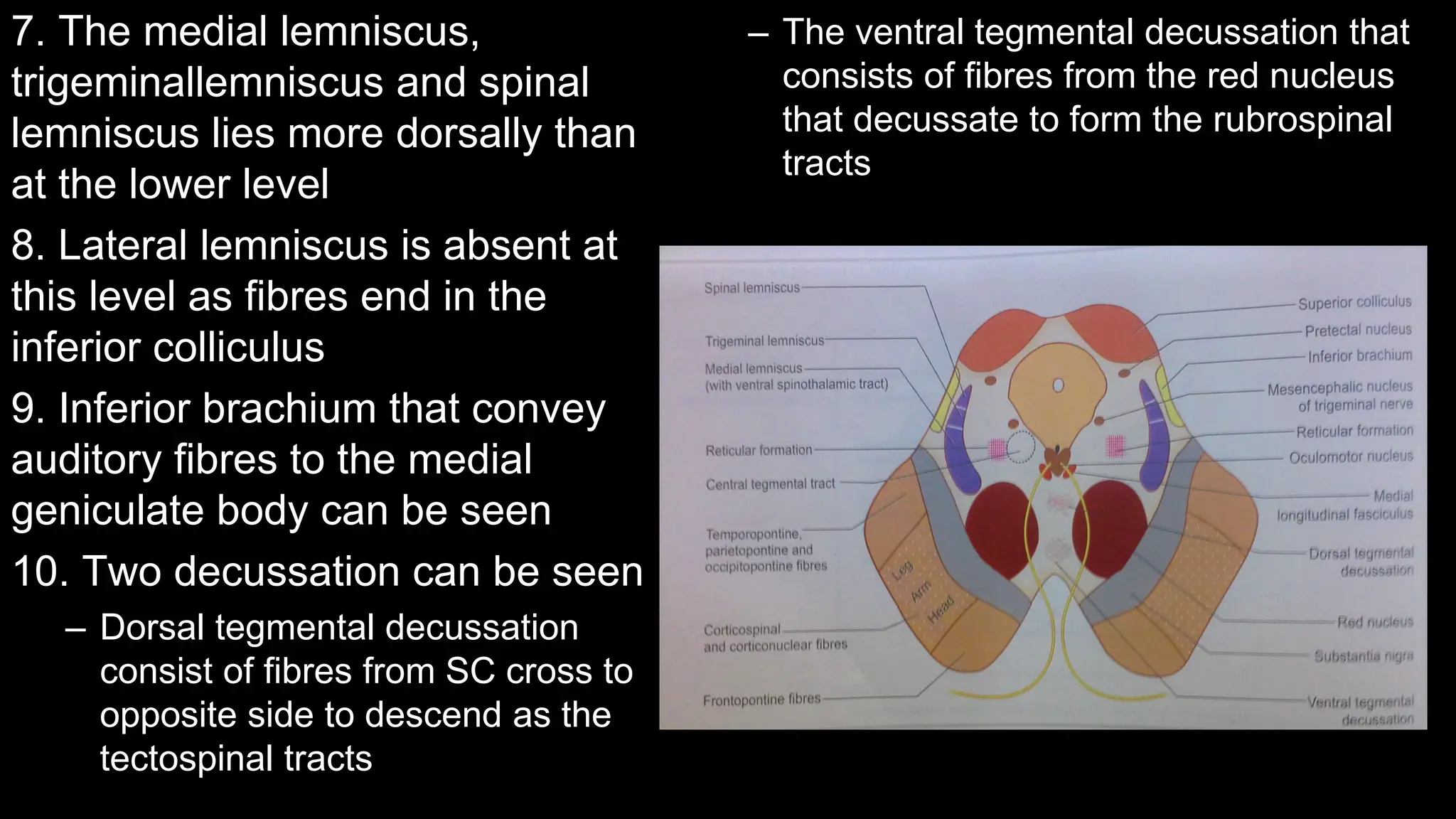 External features of brain stem (Anatomy).pdf