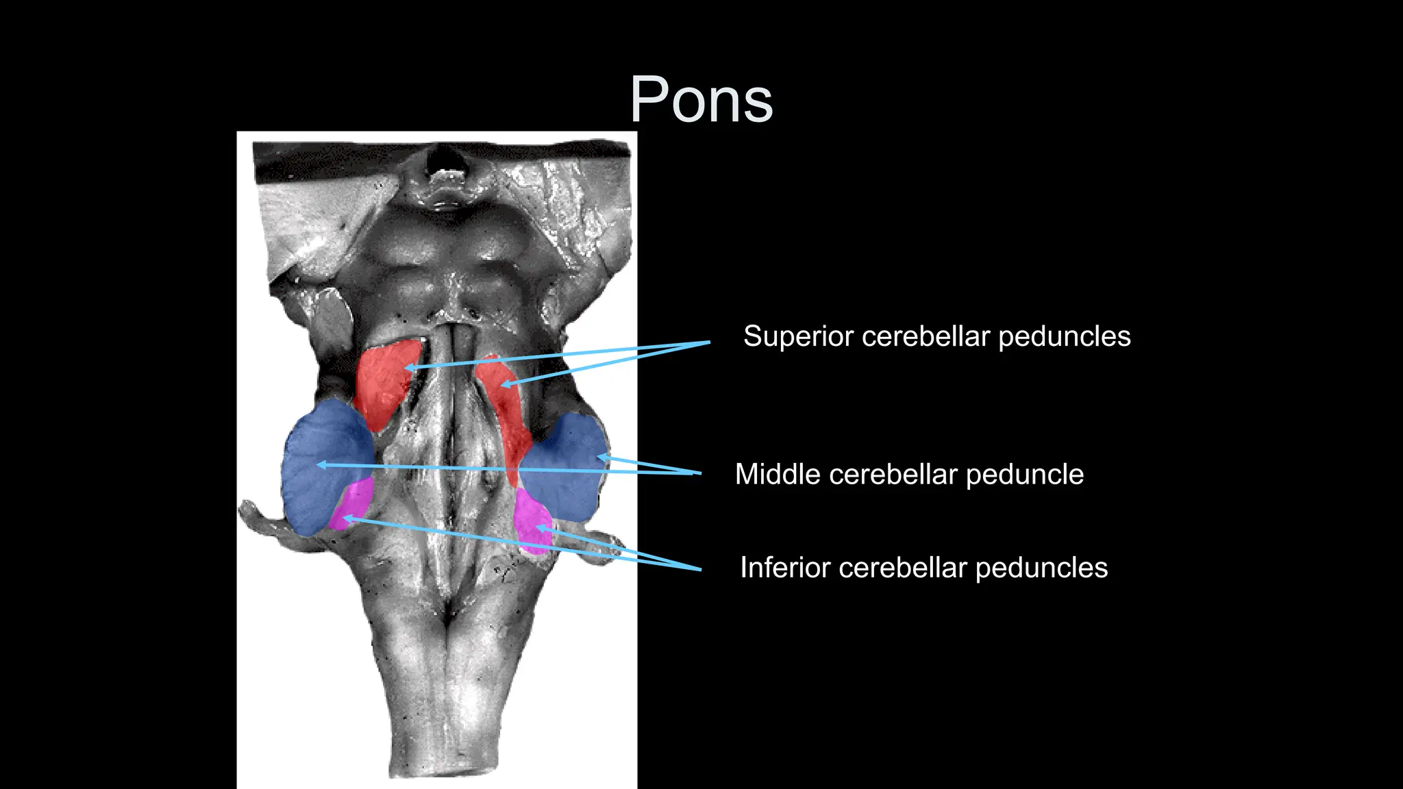 External features of brain stem (Anatomy).pdf