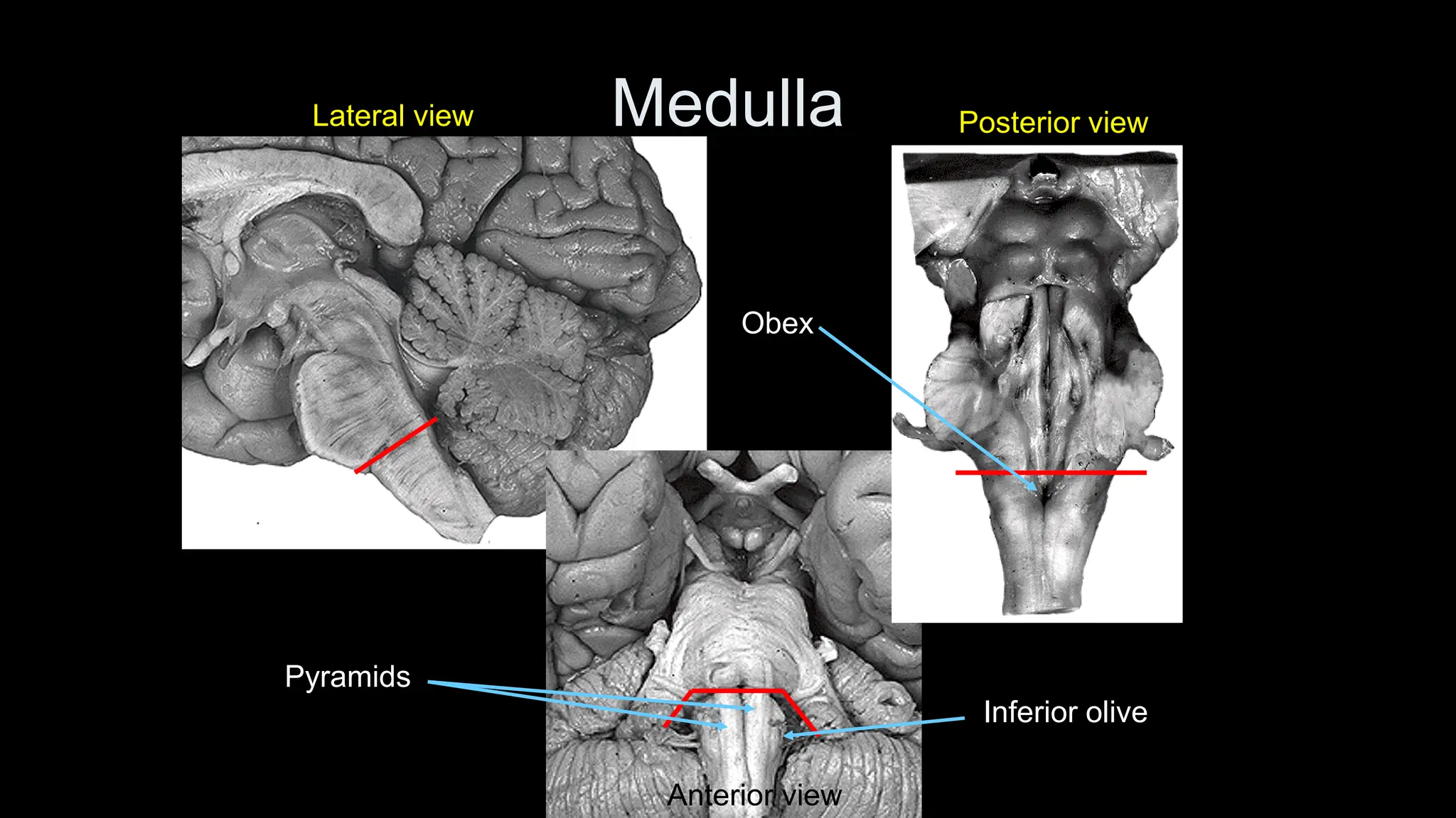 External features of brain stem (Anatomy).pdf