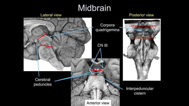 External features of brain stem (Anatomy).pdf