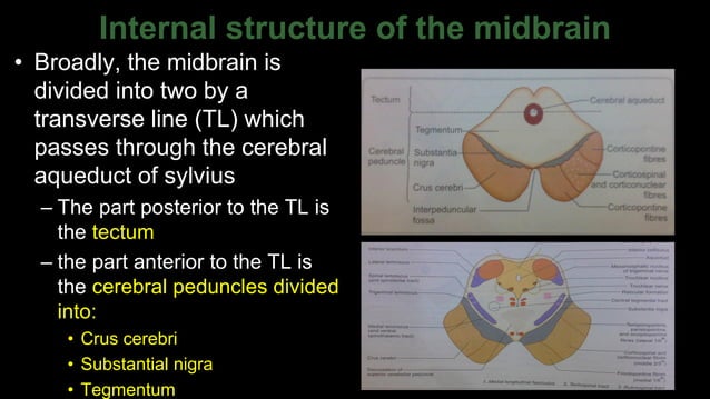 External features of brain stem (Anatomy).pdf