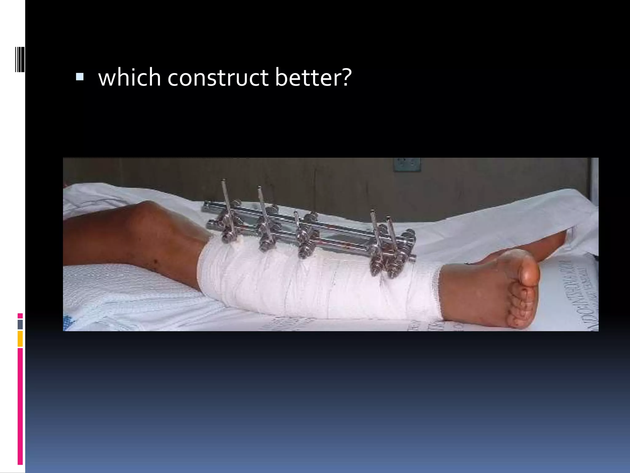 principles of External fixation | PPTX