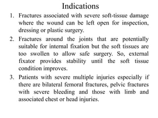 External Fixation.pptx