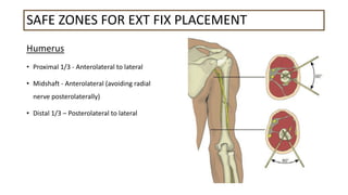 PRINCIPLE OF EXTERNAL FIXATION FOR OPEN FRACTURE.pdf