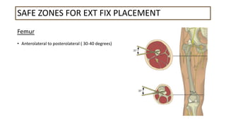 PRINCIPLE OF EXTERNAL FIXATION FOR OPEN FRACTURE.pdf