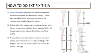 PRINCIPLE OF EXTERNAL FIXATION FOR OPEN FRACTURE.pdf
