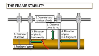 PRINCIPLE OF EXTERNAL FIXATION FOR OPEN FRACTURE.pdf