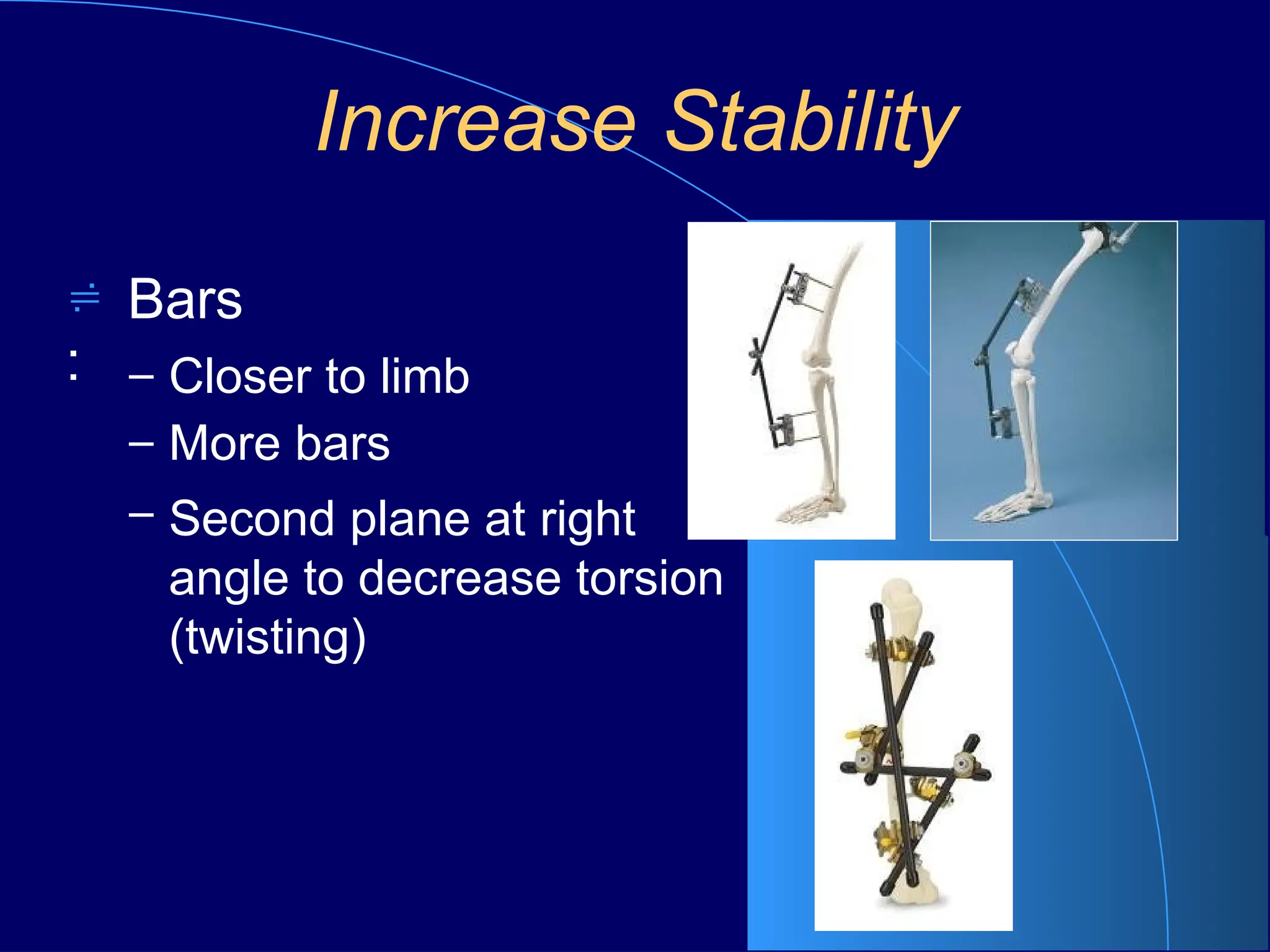 external fixation indications and techniques.pptx
