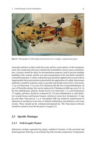 External fixation in orthopedic traumatology | PDF