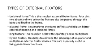 External fixation | PPTX