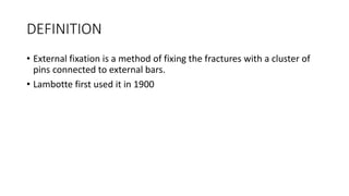 External fixation | PPTX
