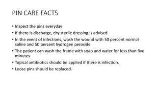 External fixation | PPTX